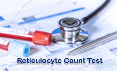 Reticulocyte Count Test Conceptual Image Stock Image F0371202