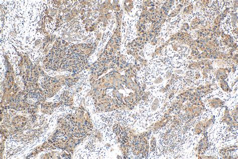 Birc6 Antibody 29760 1 Ap Proteintech