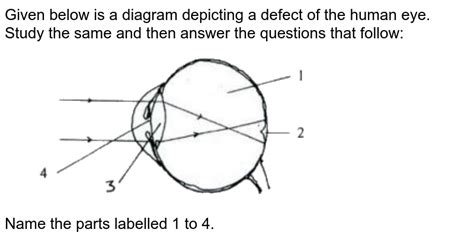 Given Below Ls A Diagram Depicting A Defect Of The Human Eye Study