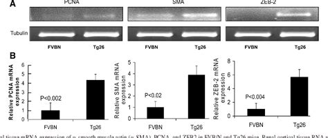 Figure 2 From Hivan Phenotype Consequence Of Epithelial Mesenchymal