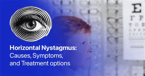 Nystagmus Surgery 5 Points To Consider