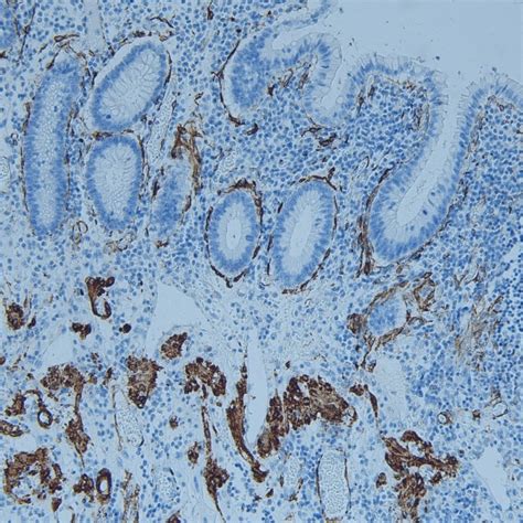 小鼠抗sma单克隆抗体anti Sma Mouse Monoclonal Antibody 生命科学产品与技术服务 生工生物工程上海股份有限公司