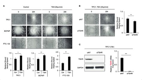 Tsh Tshr Increase Cell Migration In Thyroid Cancer Cells A Download Scientific Diagram