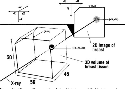 Figure 1 From Stereotactic Localization Of Breast Lesions How It Works