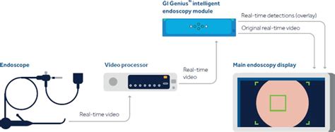 Figure 1 From Artificial Intelligence In Gastrointestinal Endoscopy Semantic Scholar