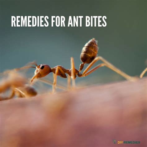 Natural Treatments And Remedies For Fire Ant Bites