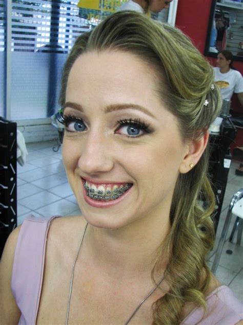 Pin By Dlawnia Shadriese On Braces Celebrities With Braces Braces Girls Cute Braces