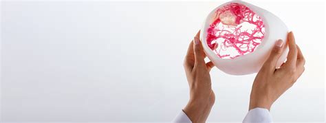 Pre Surgical Planning With Clinical Efficacy And Outcomes