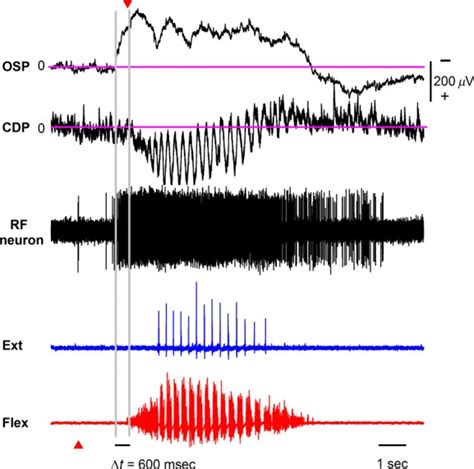 Extracellular Recording Of A Reticular Formation Rf Neuron During A Download Scientific