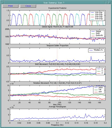 Nisox Spmd Example Multiple Condition