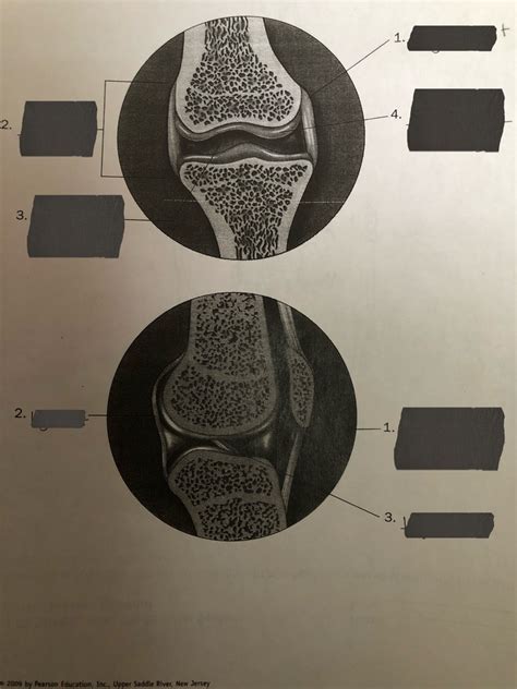 Joint Skeletal System 5 Diagram Quizlet