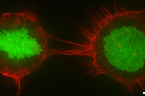 Difference Between Cell Cortex And Cytoskeleton Definition Composition Function