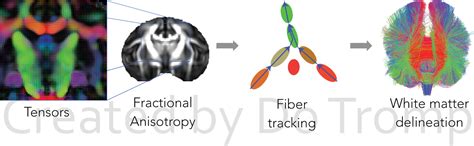 DTI Processing Voxel Based Versus Tract Based Diffusion Imaging Diffusion Imaging