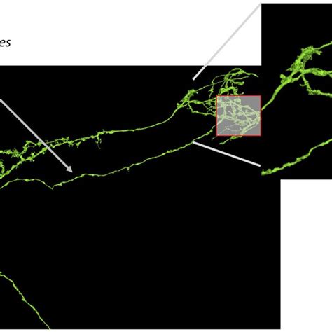 Small Segmentation Errors Locally Can Lead To Large Topological Errors