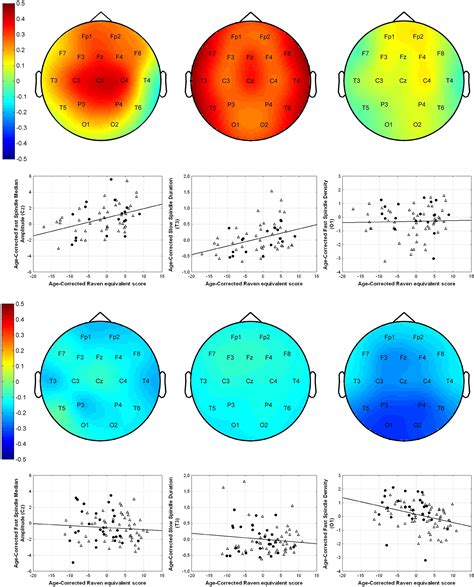 Sleep Spindles And Intelligence Evidence For A Sexual Dimorphism