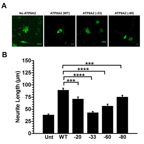 Effect Of C Terminal Truncation On Neurite Extension In PC12 Cells Download Scientific Diagram