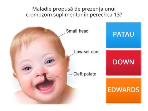 Maladiile Ereditare Cromozomiale Quiz