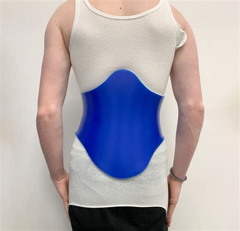 Pars Defect Condition London Orthotic Consultancy