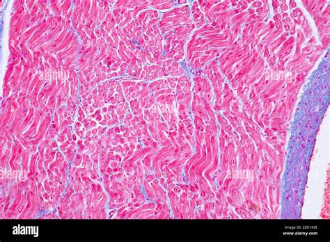Human Cardiac Muscle Light Micrograph Stock Photo Alamy