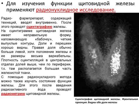 Лучевая диагностика заболеваний эндокринной системы презентация онлайн