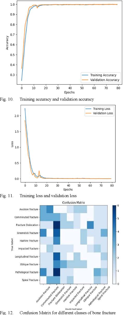 Figure 1 From Bone Fracture Detection And Classification Using Machine