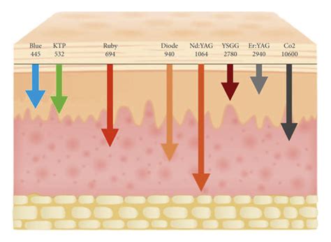Penetration Depth Of Different Laser Wavelengths Download Scientific Diagram