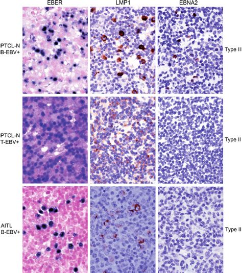 Ebv Latency Patterns In B Ebv ϩ Ptcl Nos Upper Panel T Ebv ϩ Download Scientific Diagram