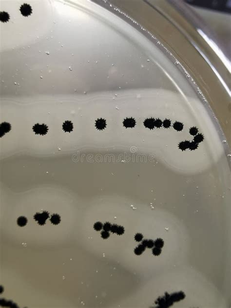 Staphylococcus Aureus On Baird Parker Agar Stock Image Image Of Bacterium Condition 298503665