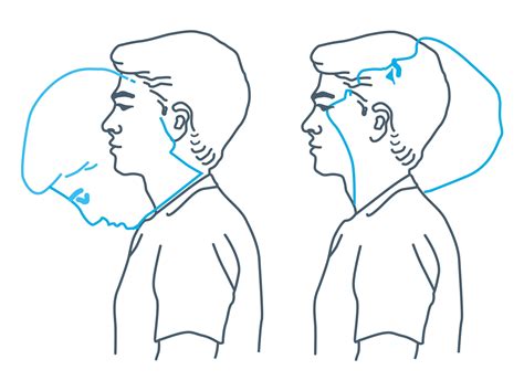 Neck Dissection Treatment And Aftercare South Tees Hospitals Nhs