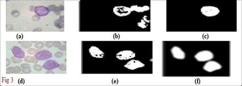 Cells Overlap Splitting And Extract The Cell A Original All Image