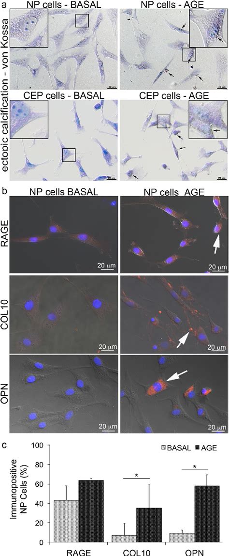 Figure 4 From Ages Induce Ectopic Endochondral Ossification In Intervertebral Discs Semantic