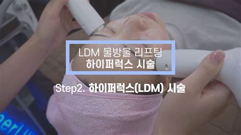 광주엘리스의원 하이퍼럭스 Ldm 시술 과정 Youtube