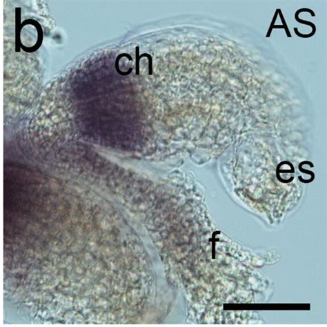 Spatiotemporal Expression Pattern Of Tfpmei1 Detected By Whole Mount