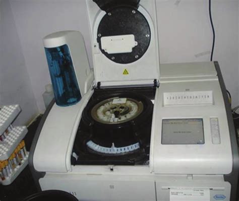 Biochemical Analyzer Cobas C 111 For The Estimation Of C Reactive Protein Download