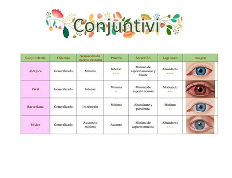 Conjuntivitis Samolguin Udocz