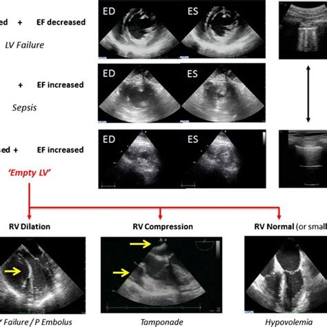 Algorithm For The Differentiation Of Hypotension Modified From Figure