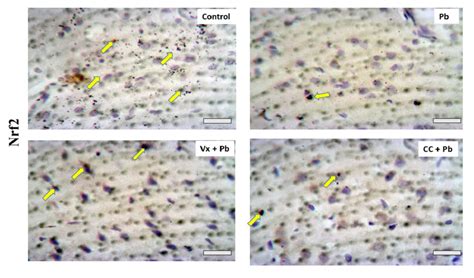 Representative Photomicrograph Of Nuclear Factor Erythroid 2 Related