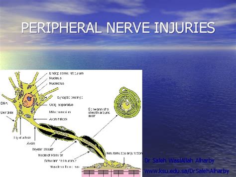 Peripheral Nerves Injuries Dr Saleh W Alharby Professor