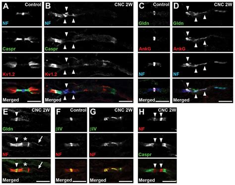 Disrupted Molecular Organization At Nodes Ab Sections Of Control Download Scientific