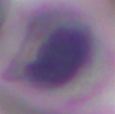 Misclassified Samples Of Sipakmed Sci Dataset Originally Belonging To Download Scientific