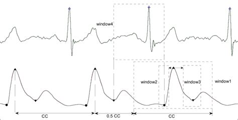 Windowing Methods In Feature Point Extraction Note Peak Of Ecg