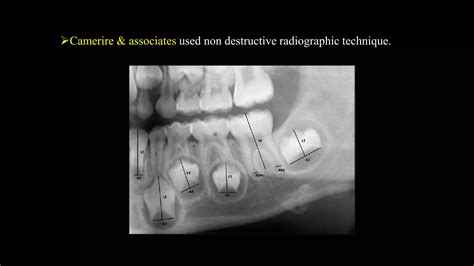 Age Estimation In Forensics Pptx Dental Health Diseases And