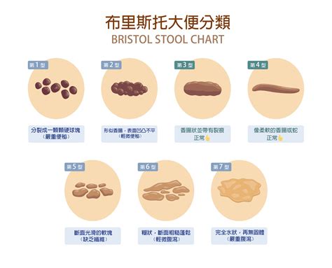 小朋友怎樣才算是便秘﹖原來便秘不只是沒有大便 醫生教你如何評估｜健康．至尚