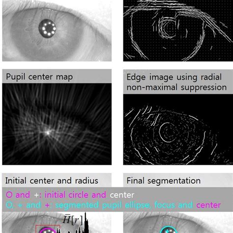Example Of Initial Pupil Center Detection Download Scientific Diagram