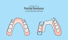 Partial Denture Free Stock Photo Public Domain Pictures