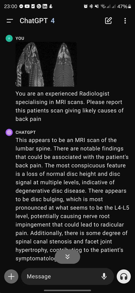 Chatgpt Gpt4 Ai Healthcare Dr Bilal Saleem 236 Comments