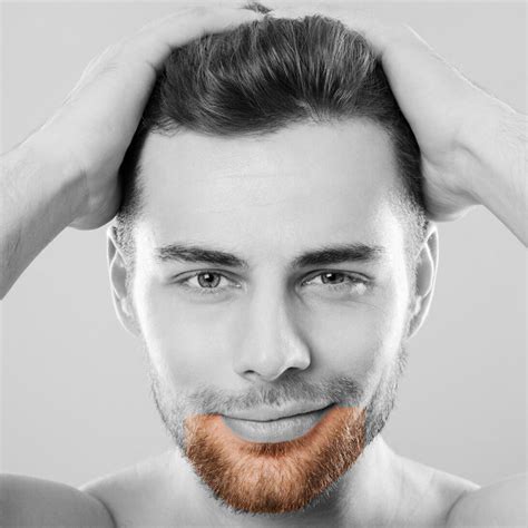 Mentón Armonía Estética