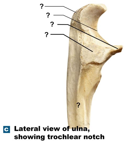 Lateral View Of Ulna Showing Trochlear Notch Diagram Quizlet