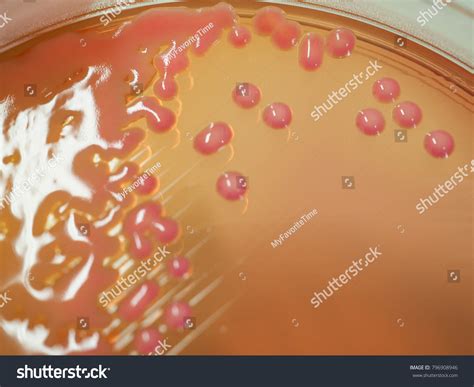 Klebsiella Macconkey Agar