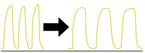 Capnography Monitoring Asthma Patients Emra